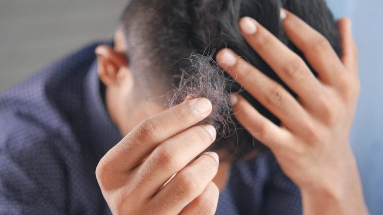 Young Indian men are battling a chronic hair fall problem. Here’s how ...