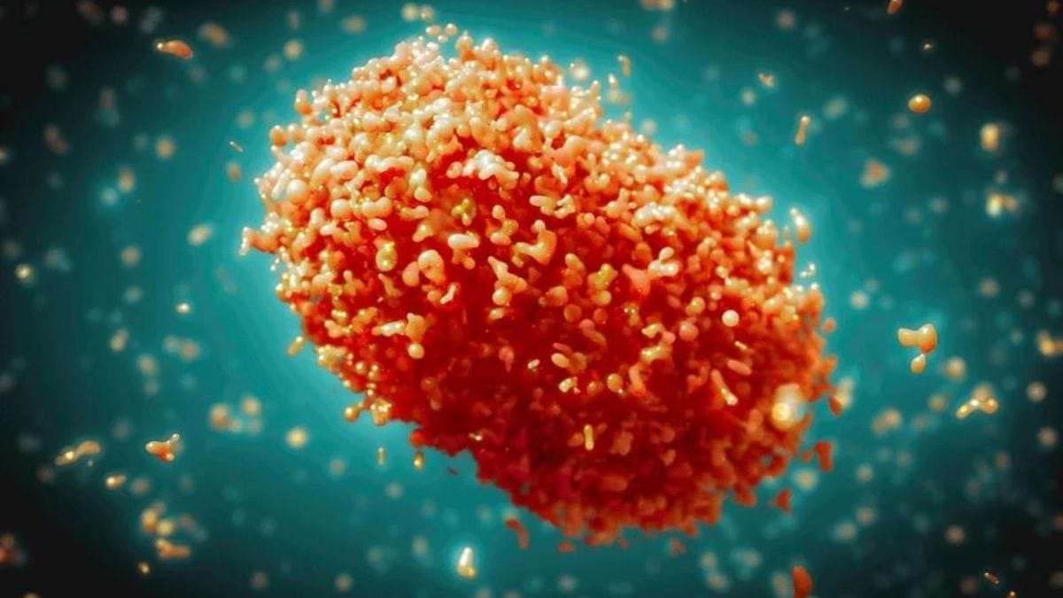Congo needs vaccines to curb mpox outbreak. West knows the danger in ...