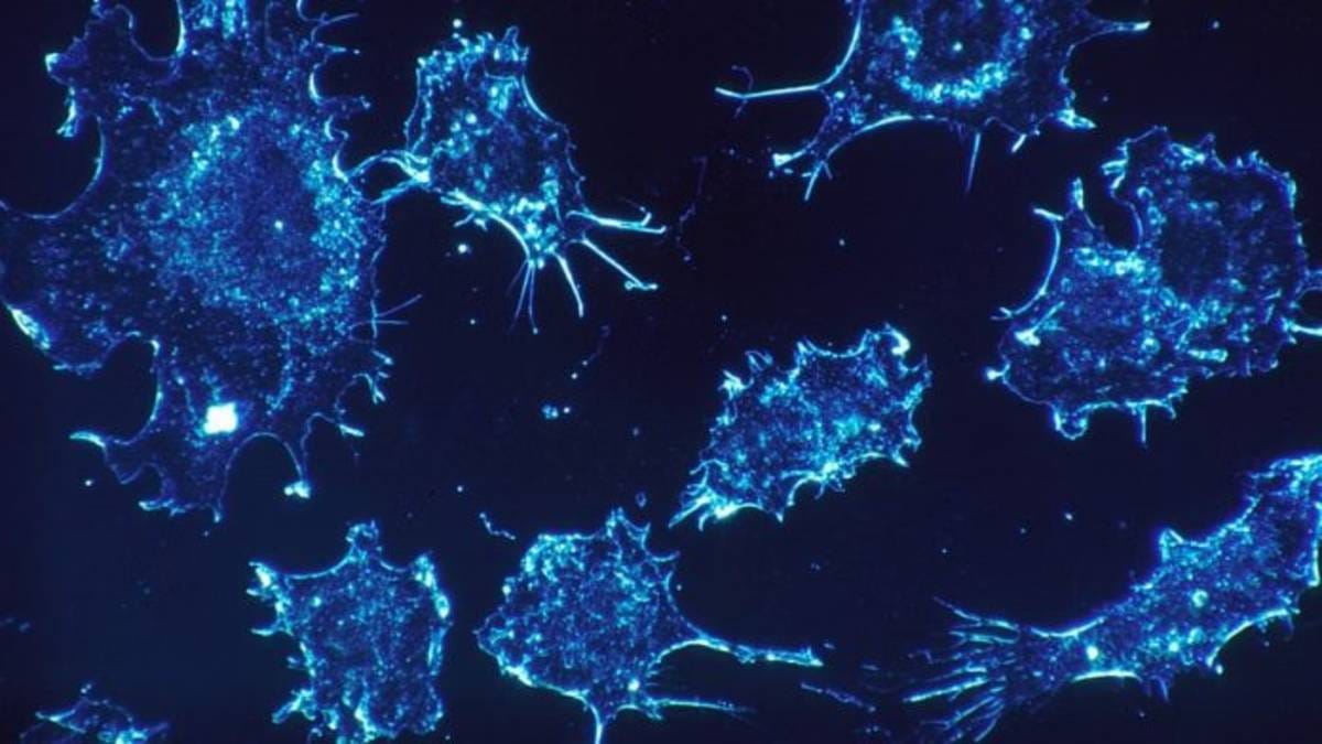 Scientists have found a way to make an army of cancer fighter cells