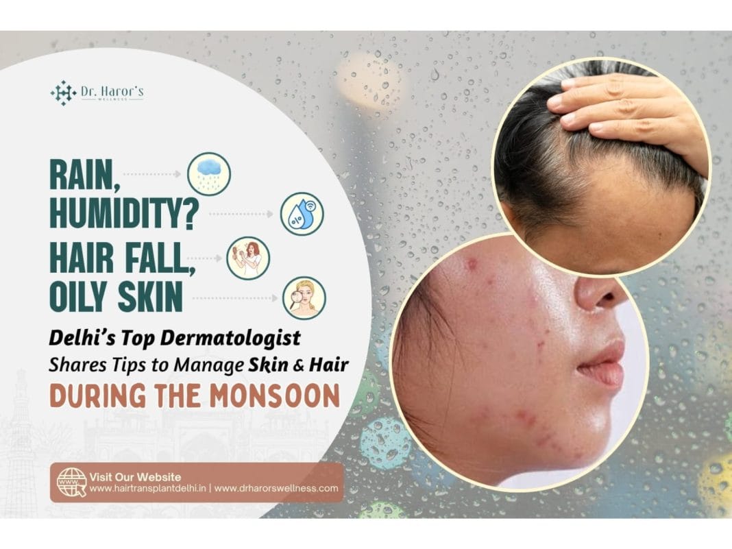 Rain, Humidity, Hair Fall, Oily Skin? Delhi's Top Dermatologist Shares ...